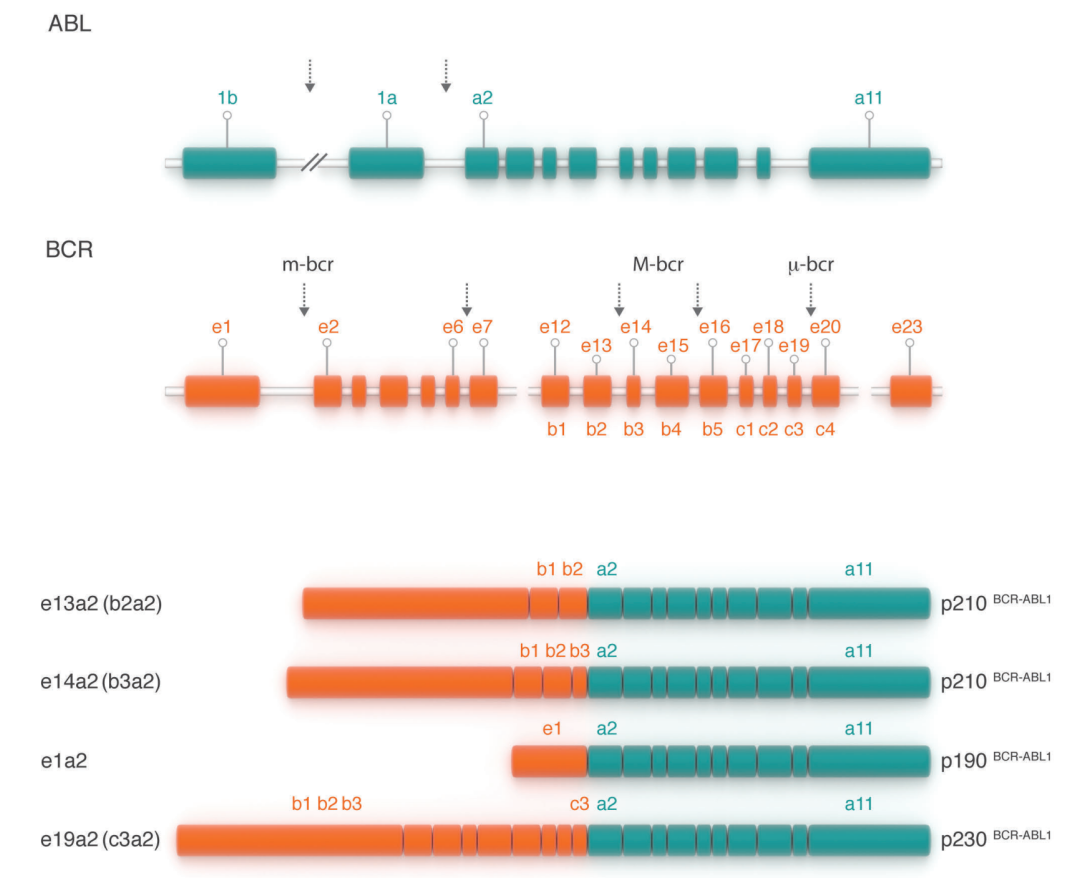 慢性髓性白血病诊疗过程BCR-ABL1融合基因与ABL激酶区突变的检测