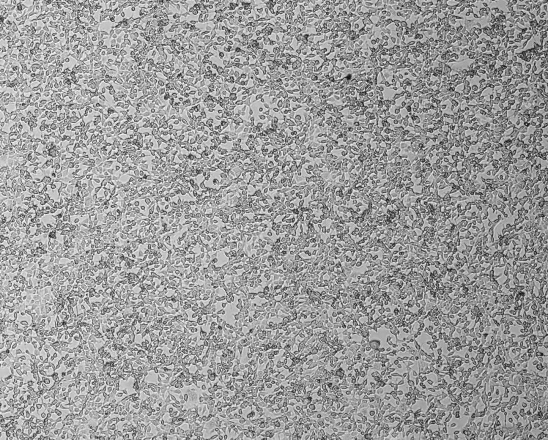 CT26.WT(小鼠结肠癌细胞)培养教程