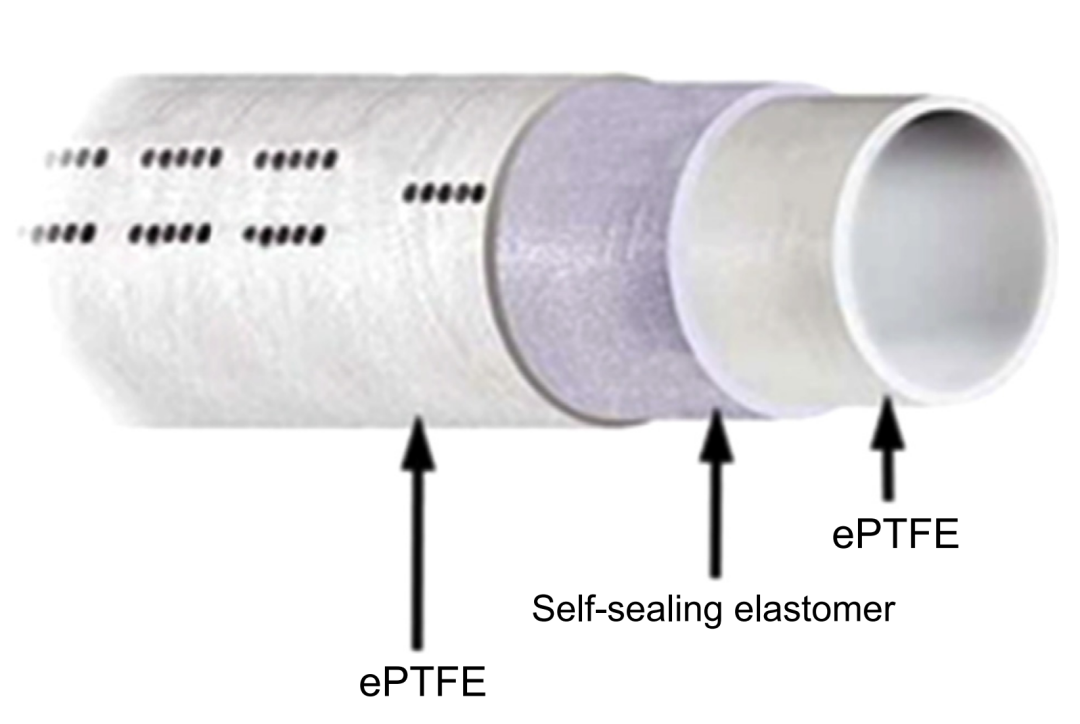 膨体聚四氟乙烯（ePTFE）覆膜支架工艺