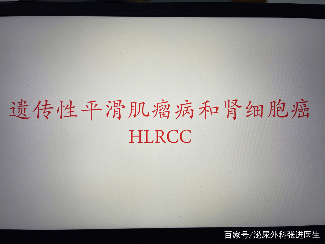 遗传性平滑肌瘤病和肾细胞癌HLRCC—上海仁济医院治疗中心