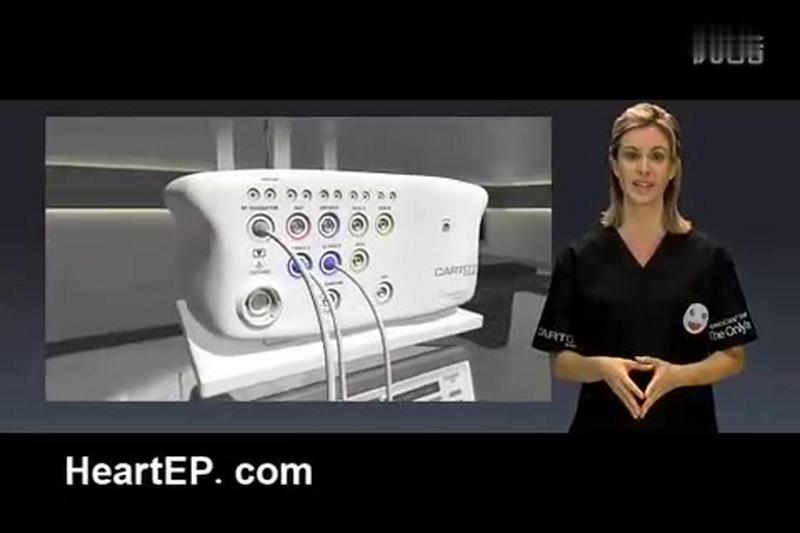 Carto3 三维电解剖标测系统介绍,科技,软件,好看视频