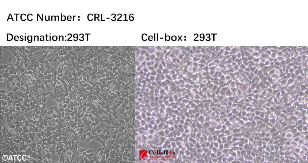 关于293T细胞培养的那些事！