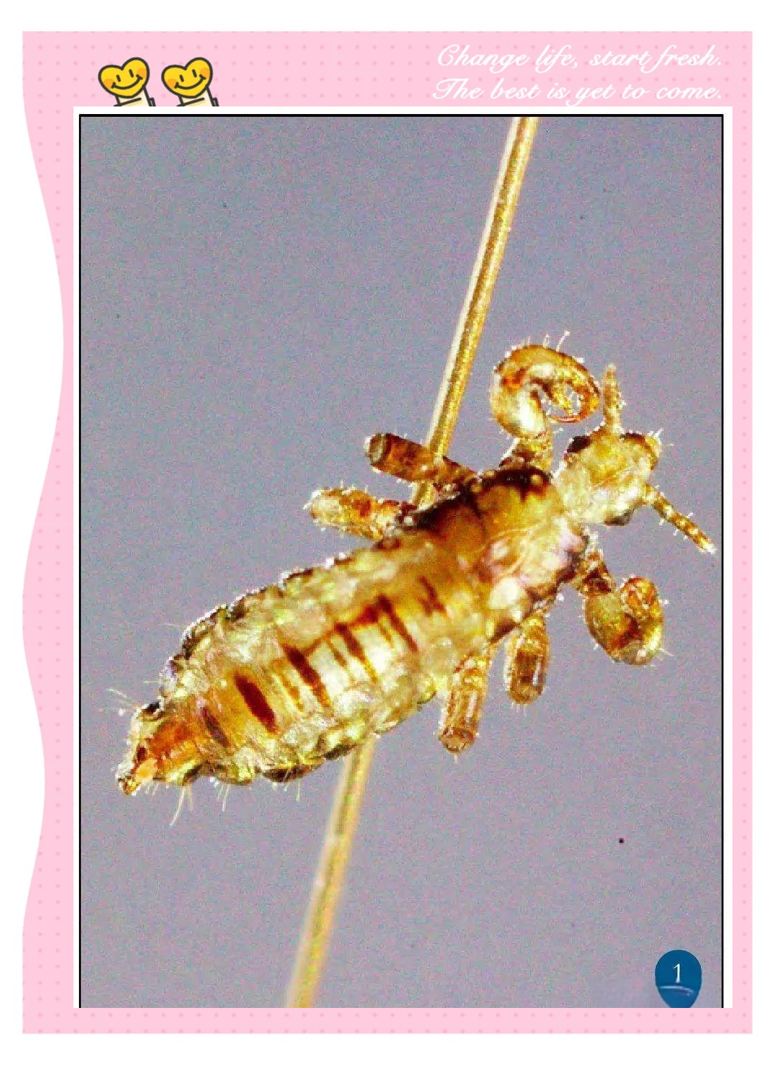 昆虫胸足的8种类型，你了解它们的功能吗