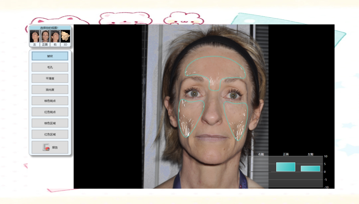 利用3D LifeViz技术，医美整形效果不再是雾里看花