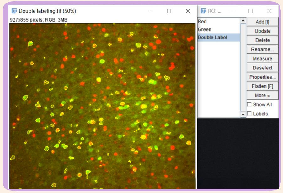 ImageJ｜荧光共标细胞计数方法详解