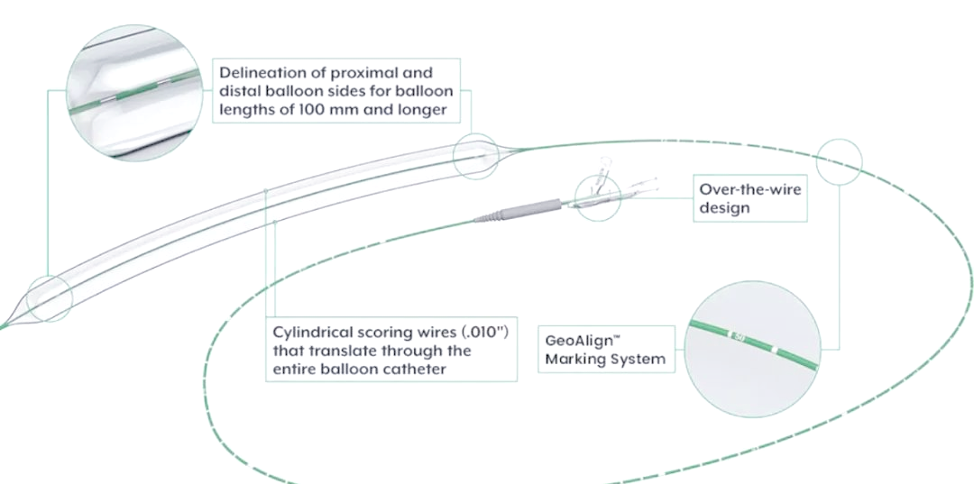 血管介入医疗器械行业特殊球囊产品全面解析