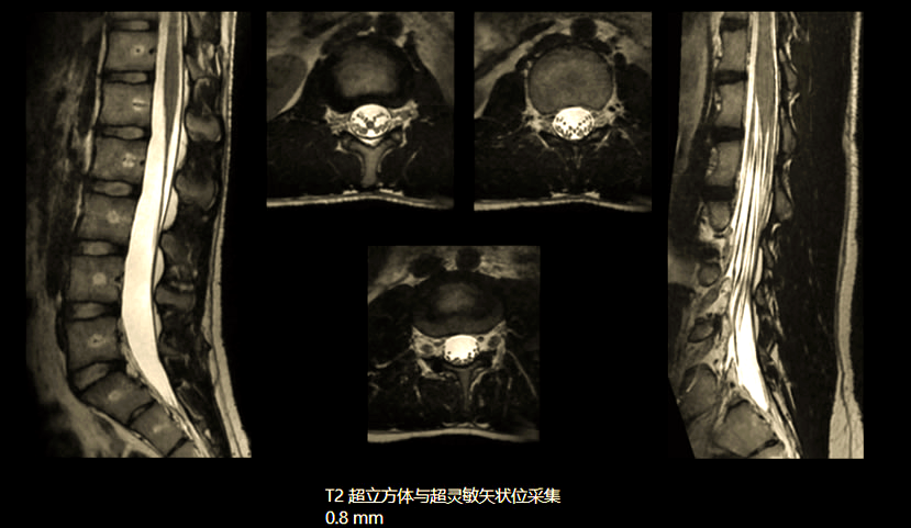 GE SIGNA™ Premier 3.0T磁共振设备在阜阳市肿瘤医院正式投入使用，带来精准清晰的影像检查新体验
